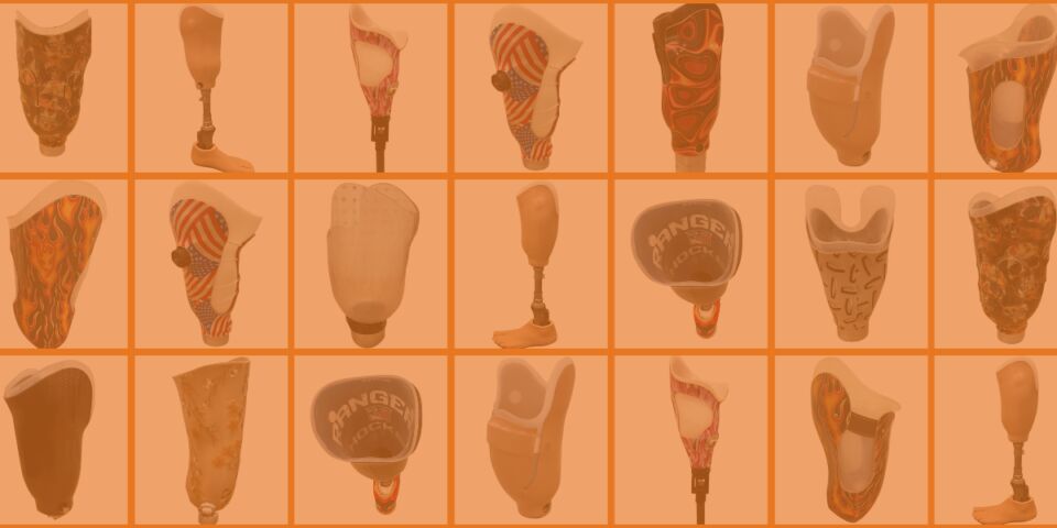 Spinal Technology | Prosthetics