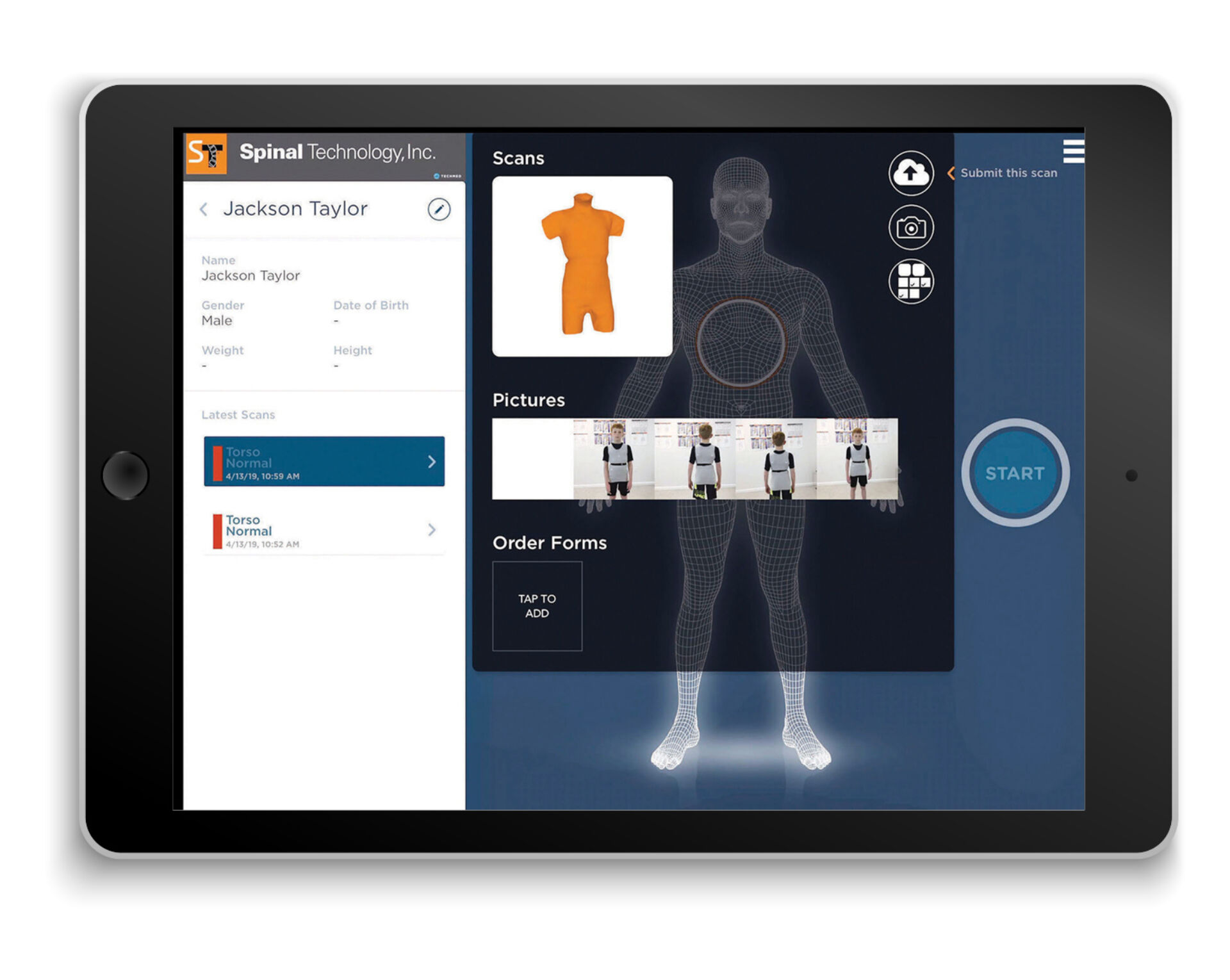 Spinal Technology | SpinalTech3D™ Scan App