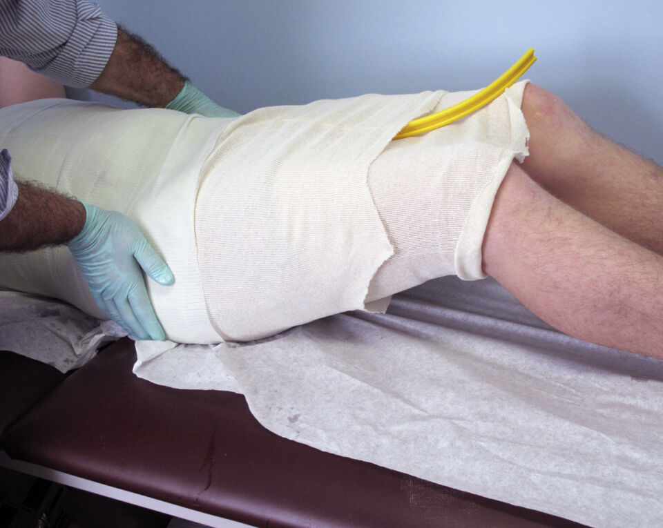 Spinal Technology | Providence® Orthosis Casting Procedure