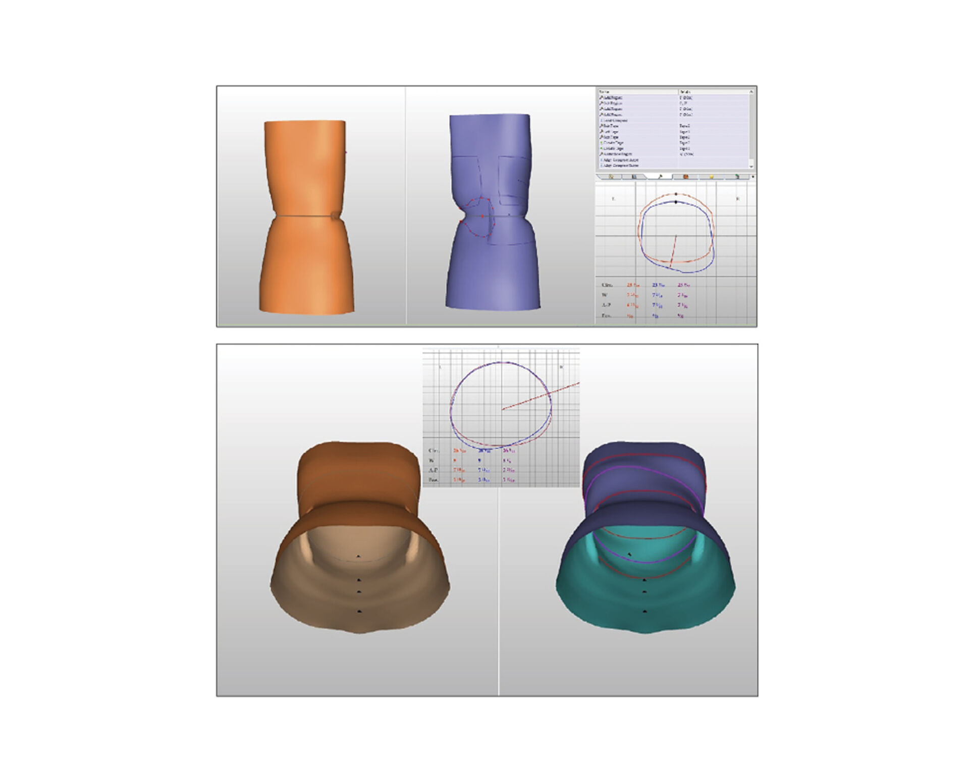 Spinal Technology | Principles of 3D Bracing – Modifications and…