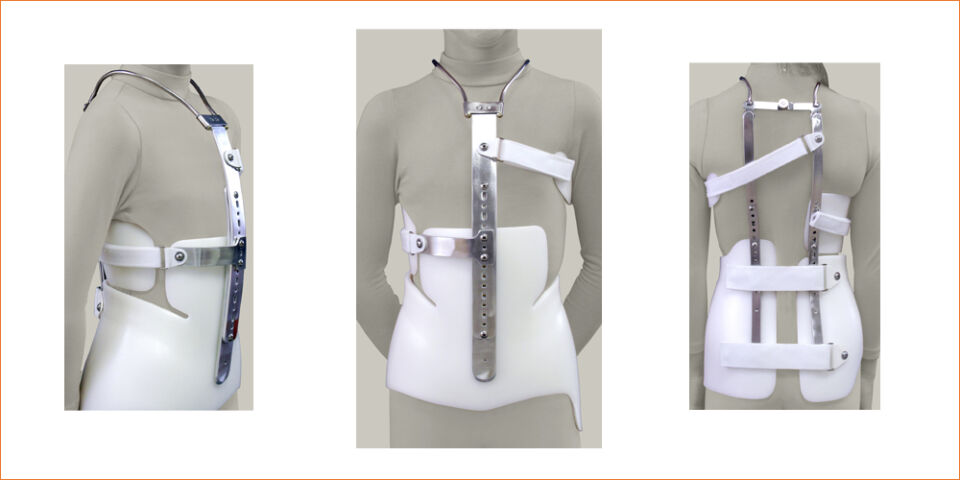 Spinal Technology | Low Profile Milwaukee Brace