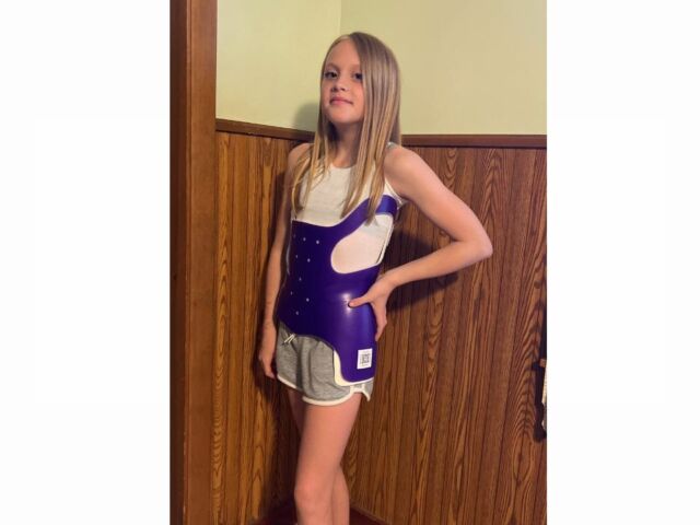 Spinal Technology | Learning You Have Scoliosis