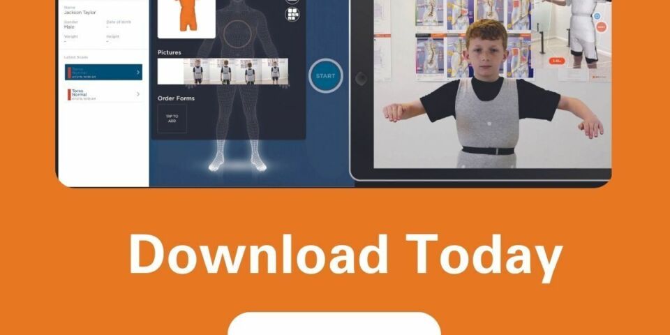 Spinal Technology | Five 3D Scanning Tips