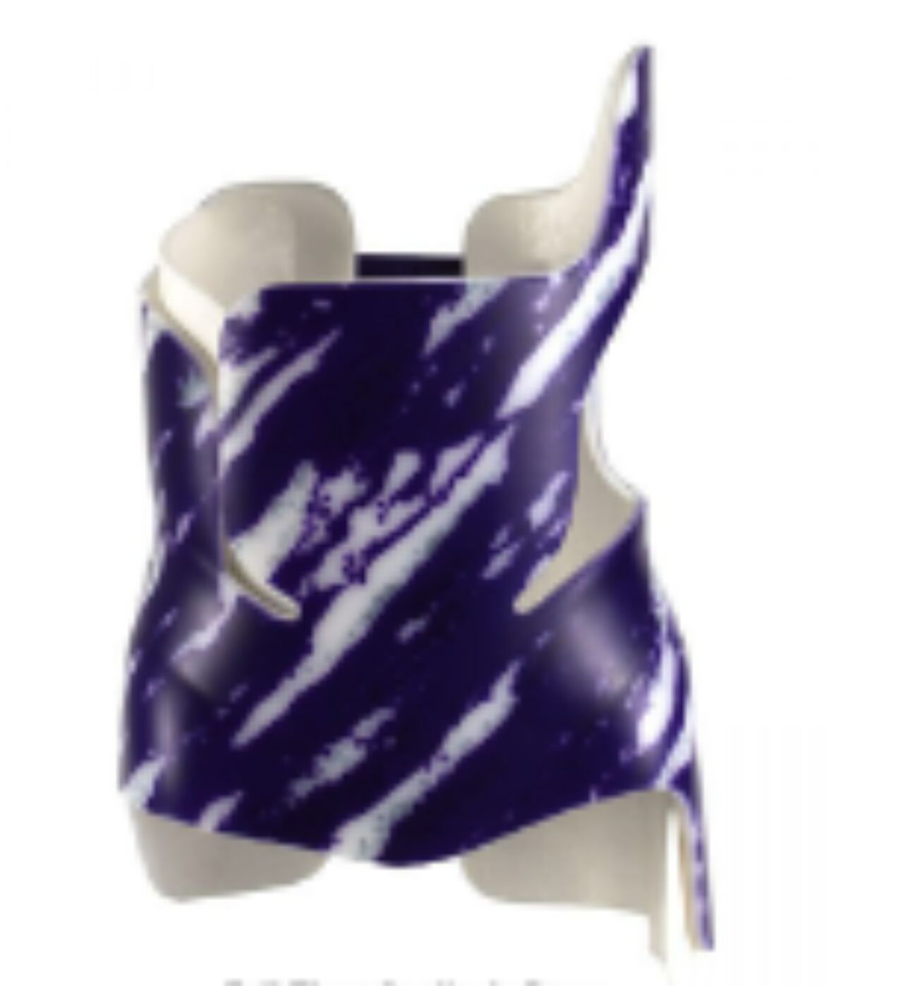 Spinal Technology | Brace Patterns Photo Gallery