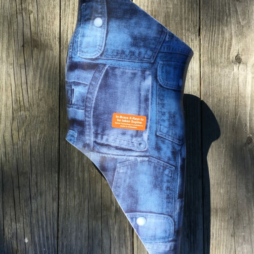 Spinal Technology | Brace Patterns Photo Gallery