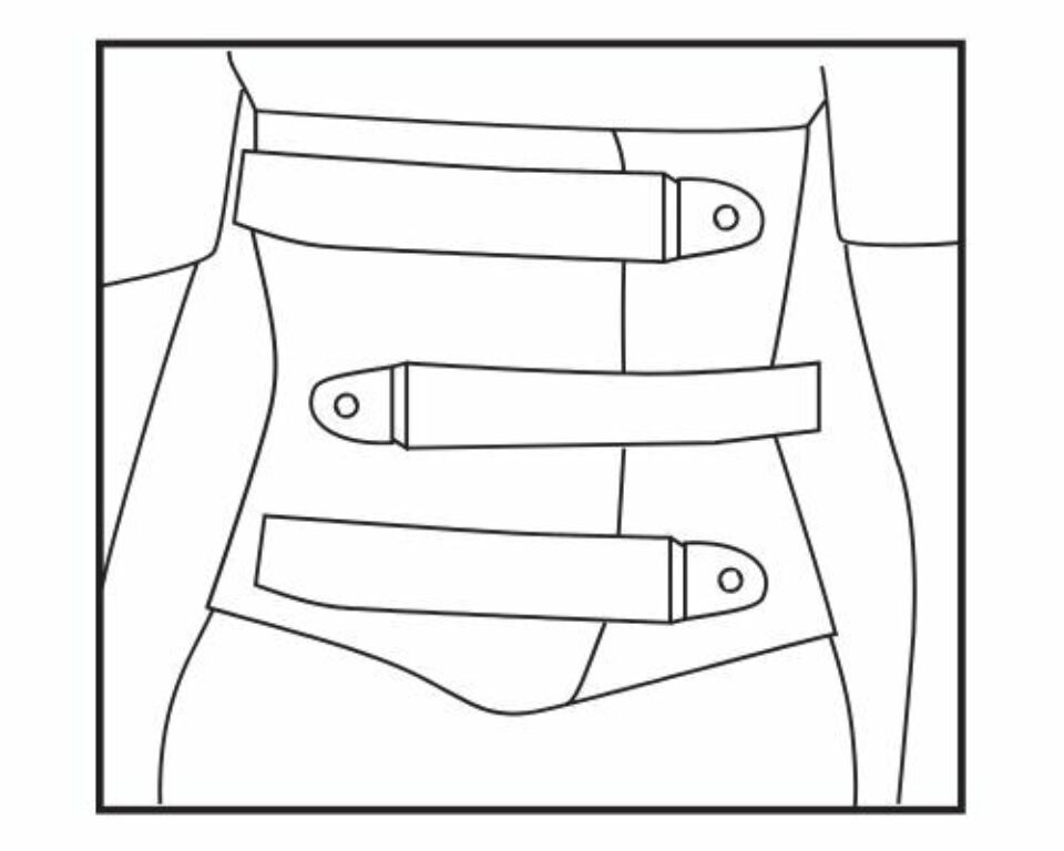 Spinal Technology | LSO- Anterior Opening Wearing Instructions