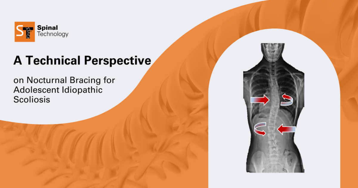 Spinal Technology | Una perspectiva técnica
