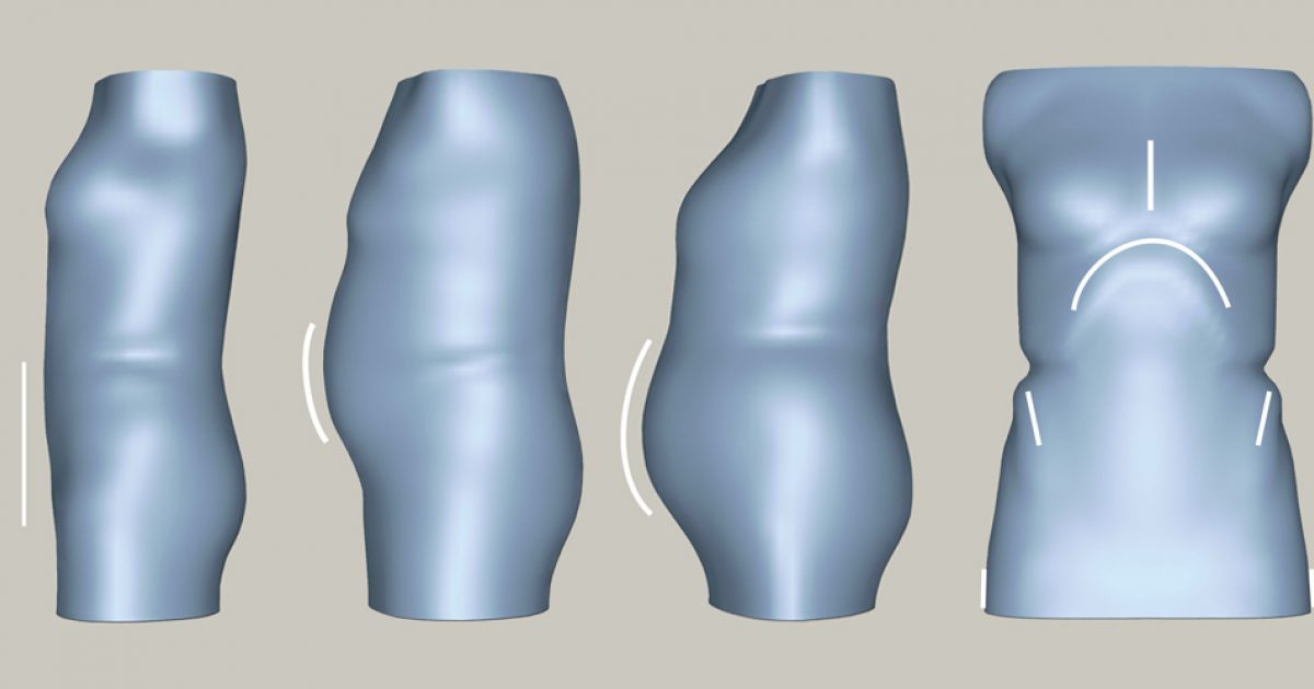 Spinal Tech | Body Contours