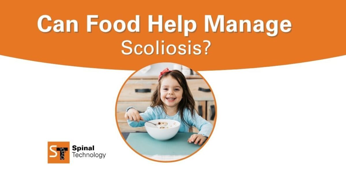 Spinal Technology | Can Food Help Manage Scoliosis?