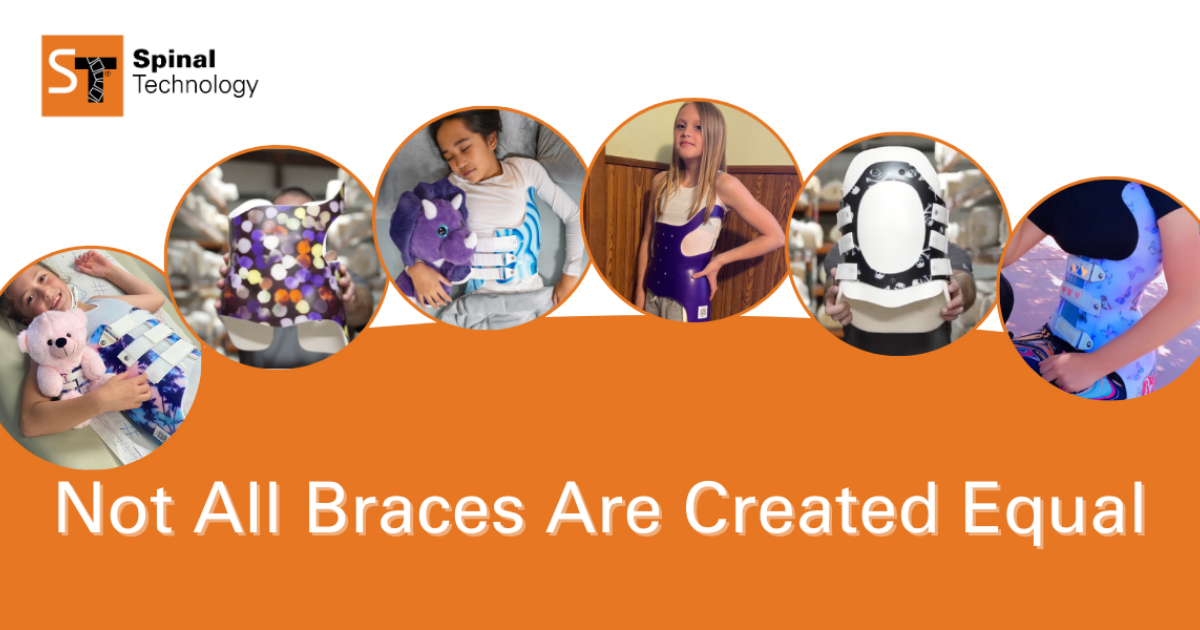 Spinal Technology | Not All Braces are Created Equal