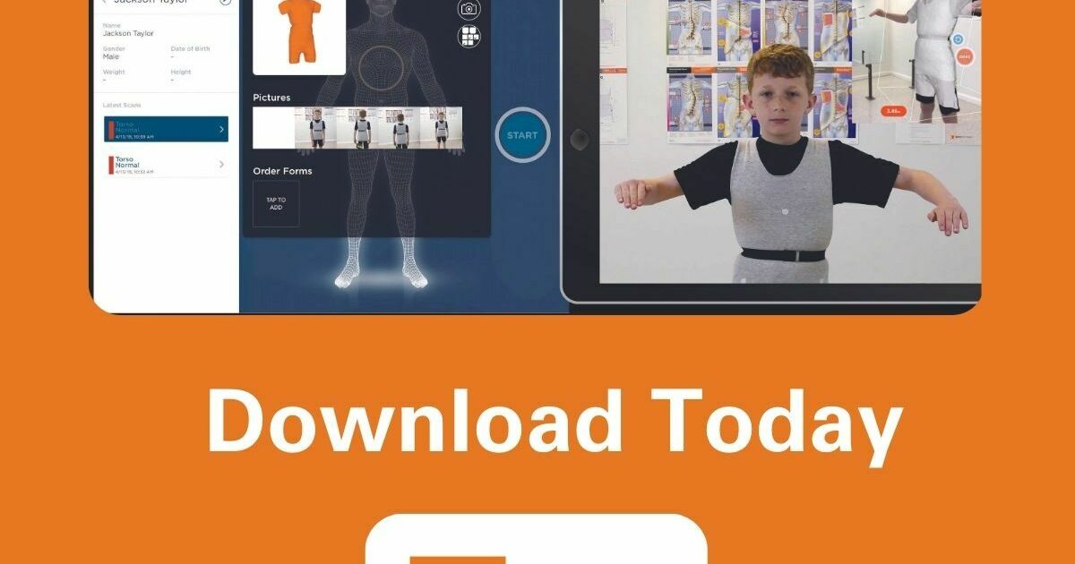 Spinal Technology | SpinalTech3D™ Scan App