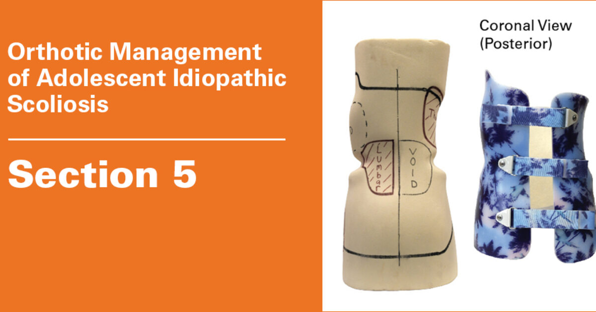 Spinal Tech | Principles of 3D Bracing – Modifications and Approach…