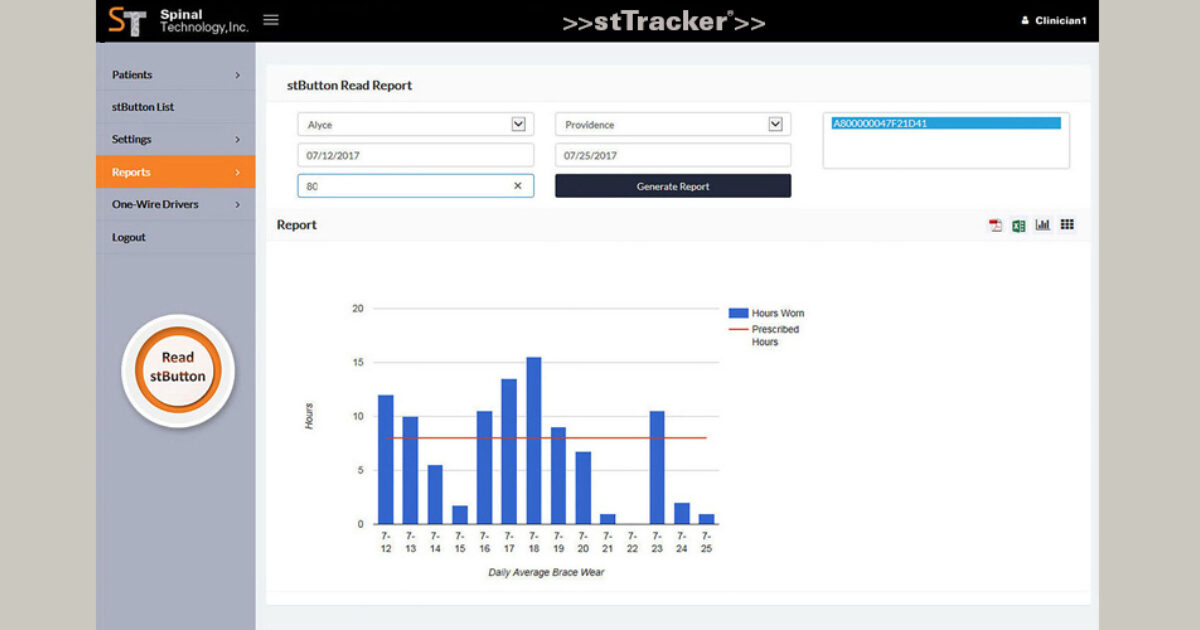 Spinal Technology | The stWear™ Compliance Monitoring System